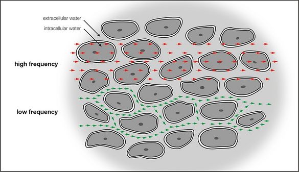 Bioimpedance analysis – it’s all about the algorithms! · seca