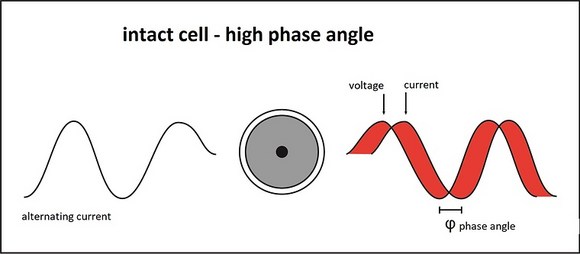 Bioimpedance analysis – it’s all about the algorithms! · seca