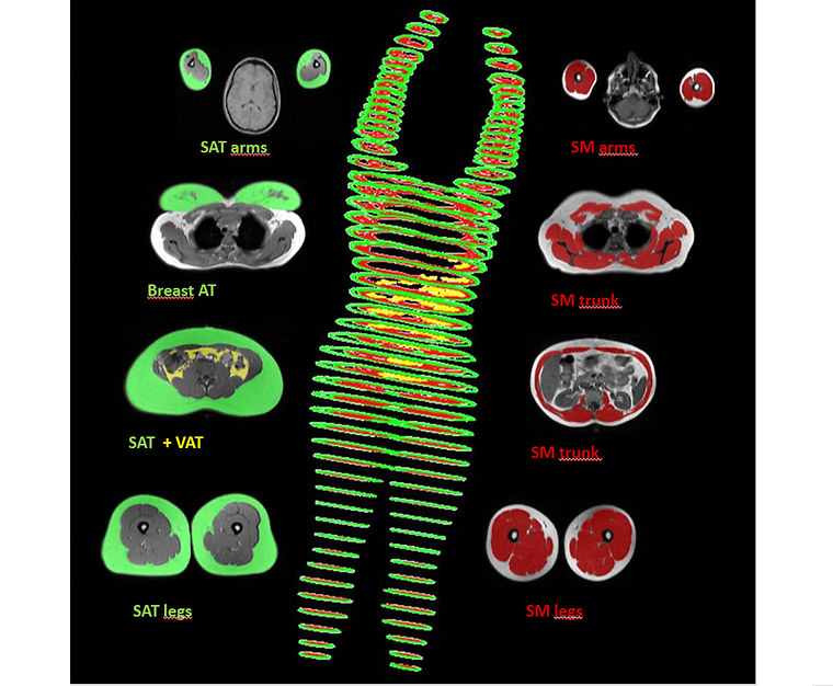 DXA - a suitable validation method for BIA devices? · seca
