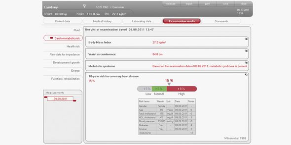 Producten » Alle producten » Produkt Details · seca